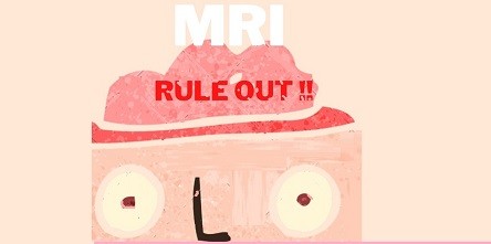 Lets Rule out !! Second Opinion whenever MRI Brain reports lesions - Blogs